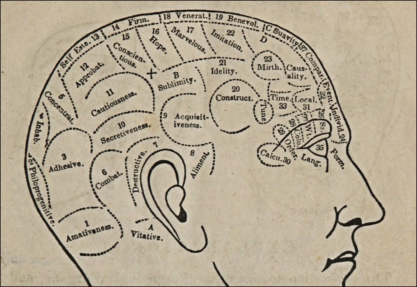 A Cabinet of Curiosities - Royal Hospital for Neuro-disability